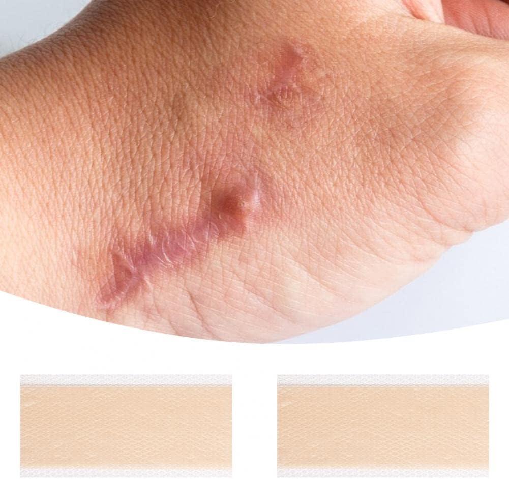 4Pcs Soft Self-Adhesive Silicone Scar Care Sheets - Surgical Scar ...