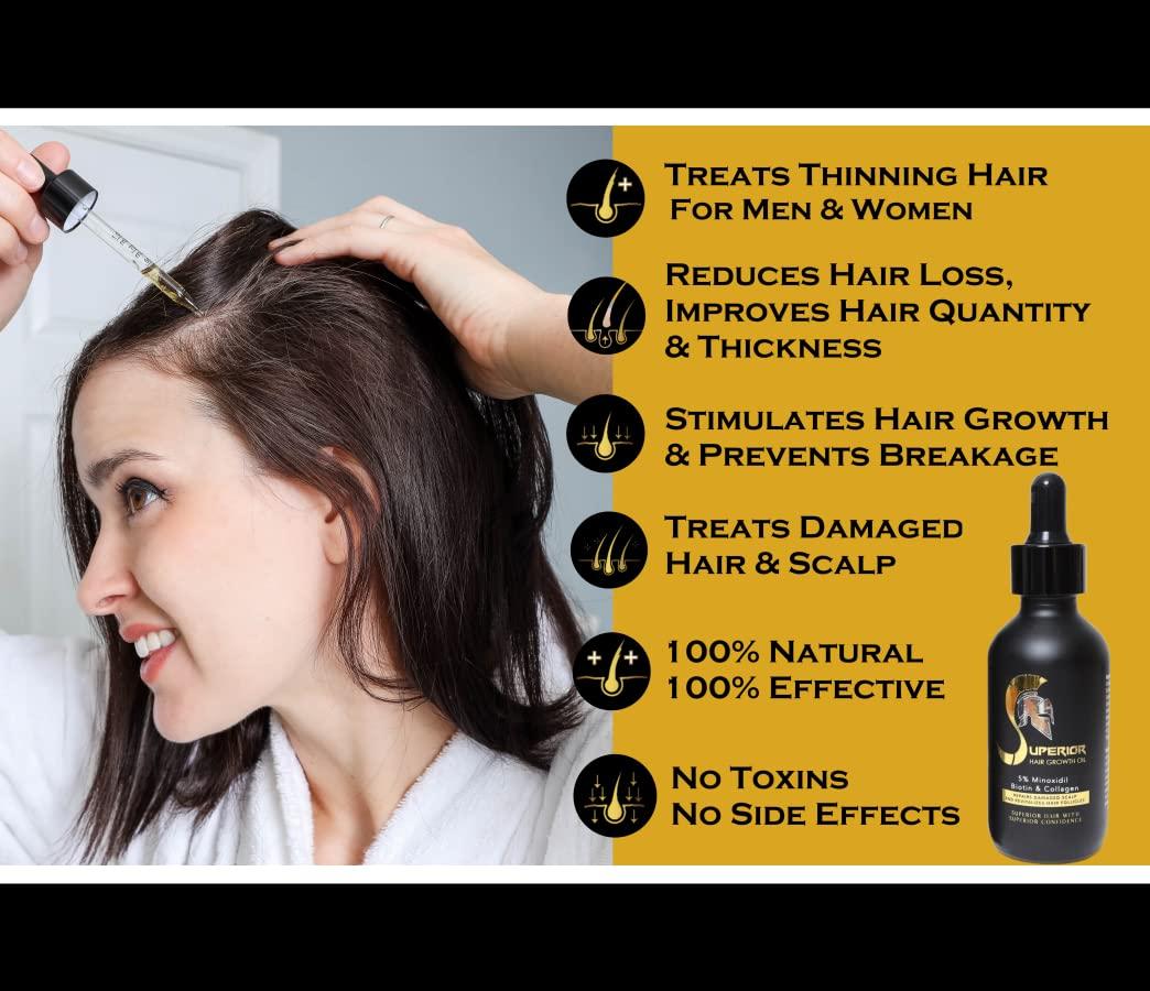 Scalp Makeup For Thinning Hair | Saubhaya Makeup