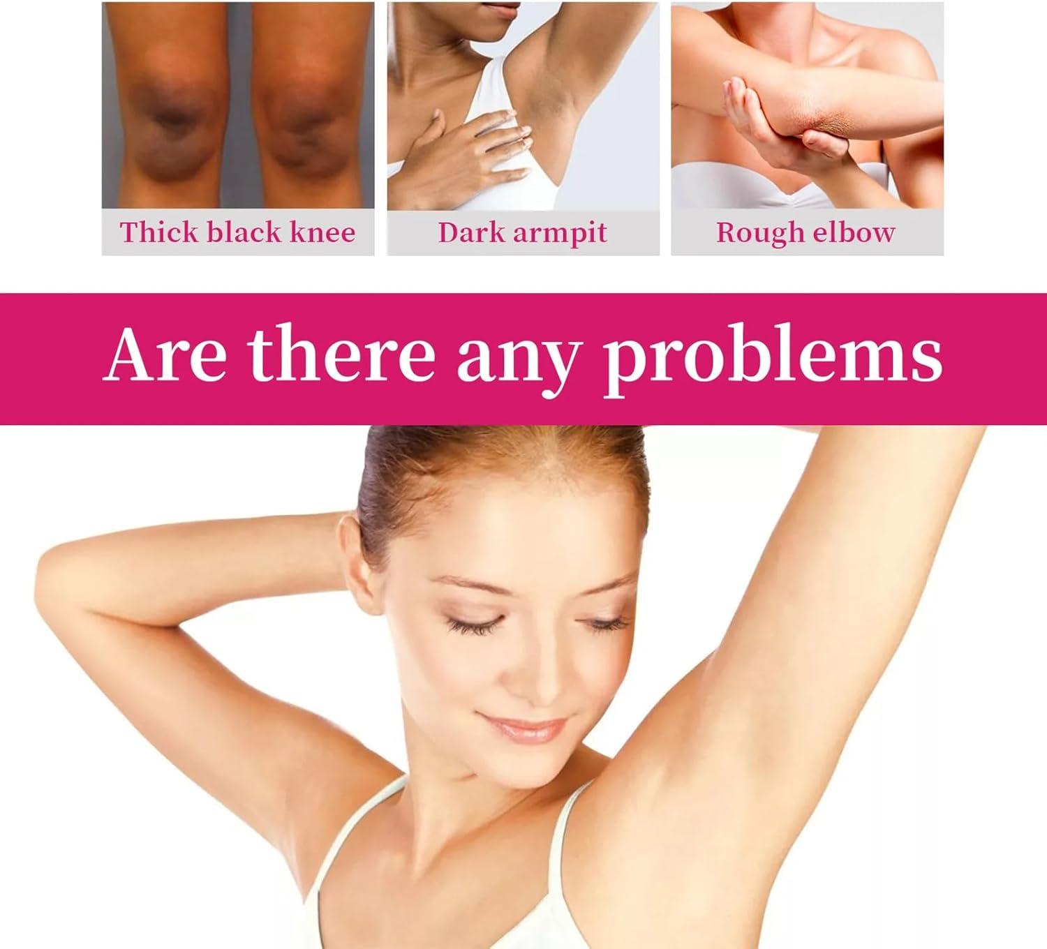 Underarm Whitening Cream - Kojic Acid Whitening Cream - Skin Lightening ...