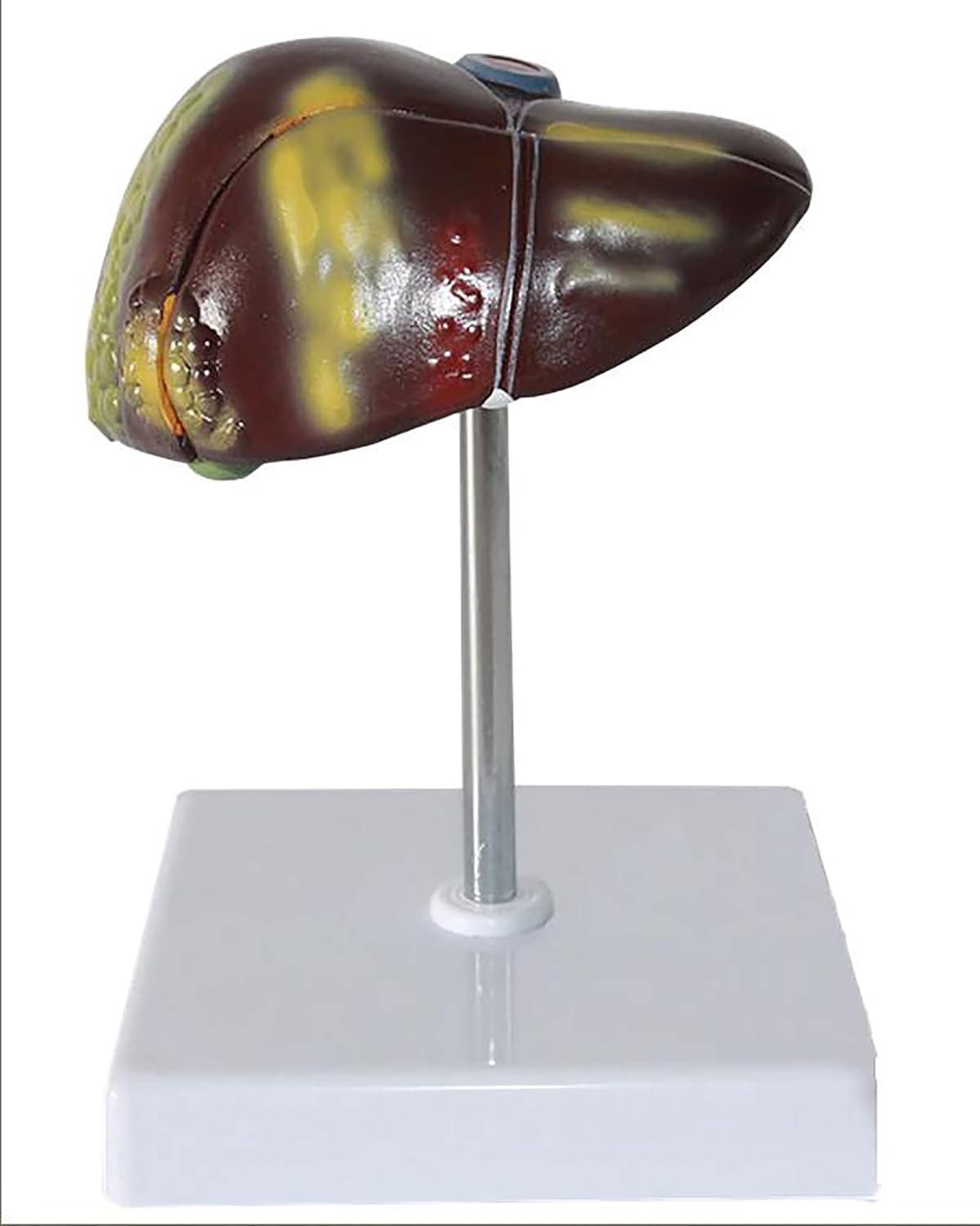 Life Size Human Liver Anatomical Model PVC Liver Pathology Model ...