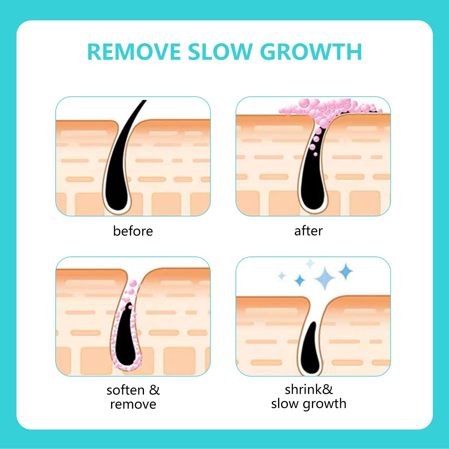 Skinetic Peach Fuzz Hair Removal Cream 100g - Gentle Hair Remover for ...