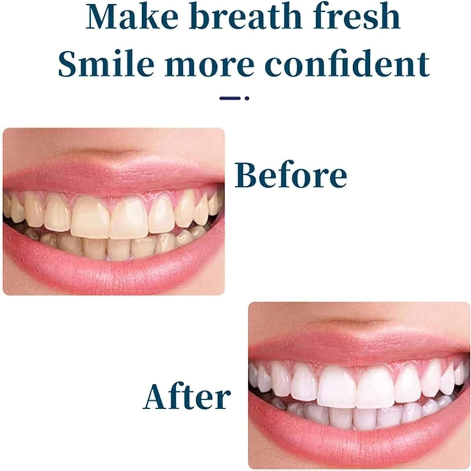Body Accel Niacinamide Whitening Toothpaste - Remove Tooth Spots ...