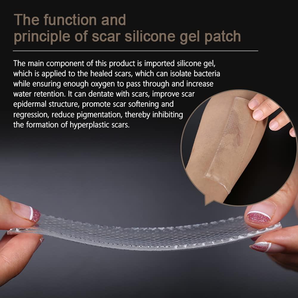 Medical Grade Silicone Scar Sheets for Surgical, C-Section, Burn & Acne ...