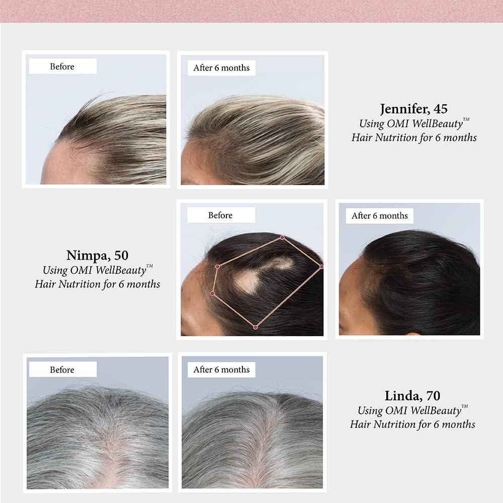 OMI Hair Nutrition Supplement - Clinically Proven for Hair Growth and ...
