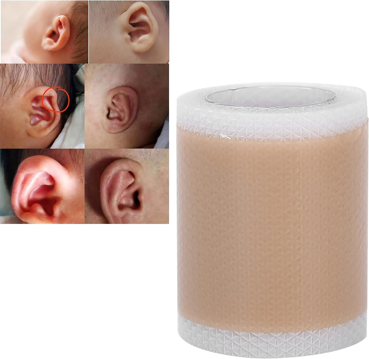 Baby Ear Corrector Silicone Kids Infant Ear Tape Scar Tape Protruding ...