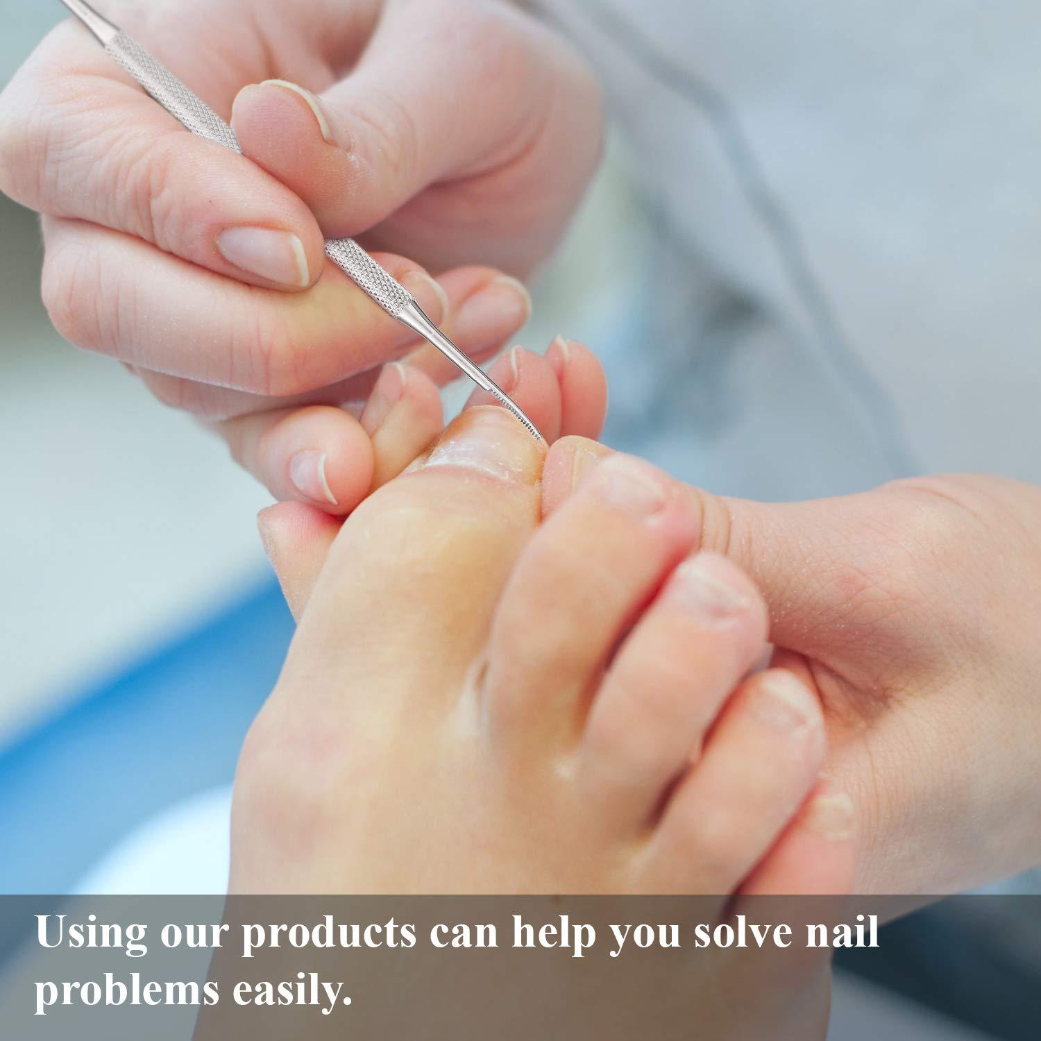 6-Pack Stainless Steel Ingrown Toenail File & Lifter Set | Double-Sided ...