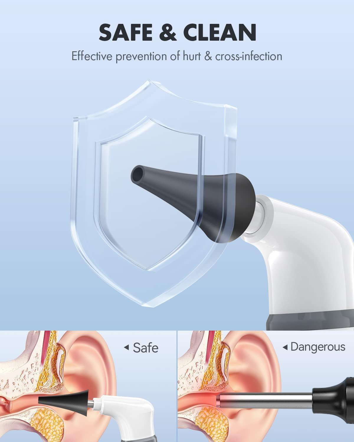 Anykit Wireless Otoscope with Ear Wax Removal Tool and Storage Case ...