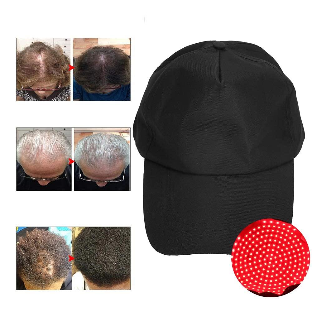 Laser Hair Growth Cap - USB Hair Loss Treatment Device for Thinning ...