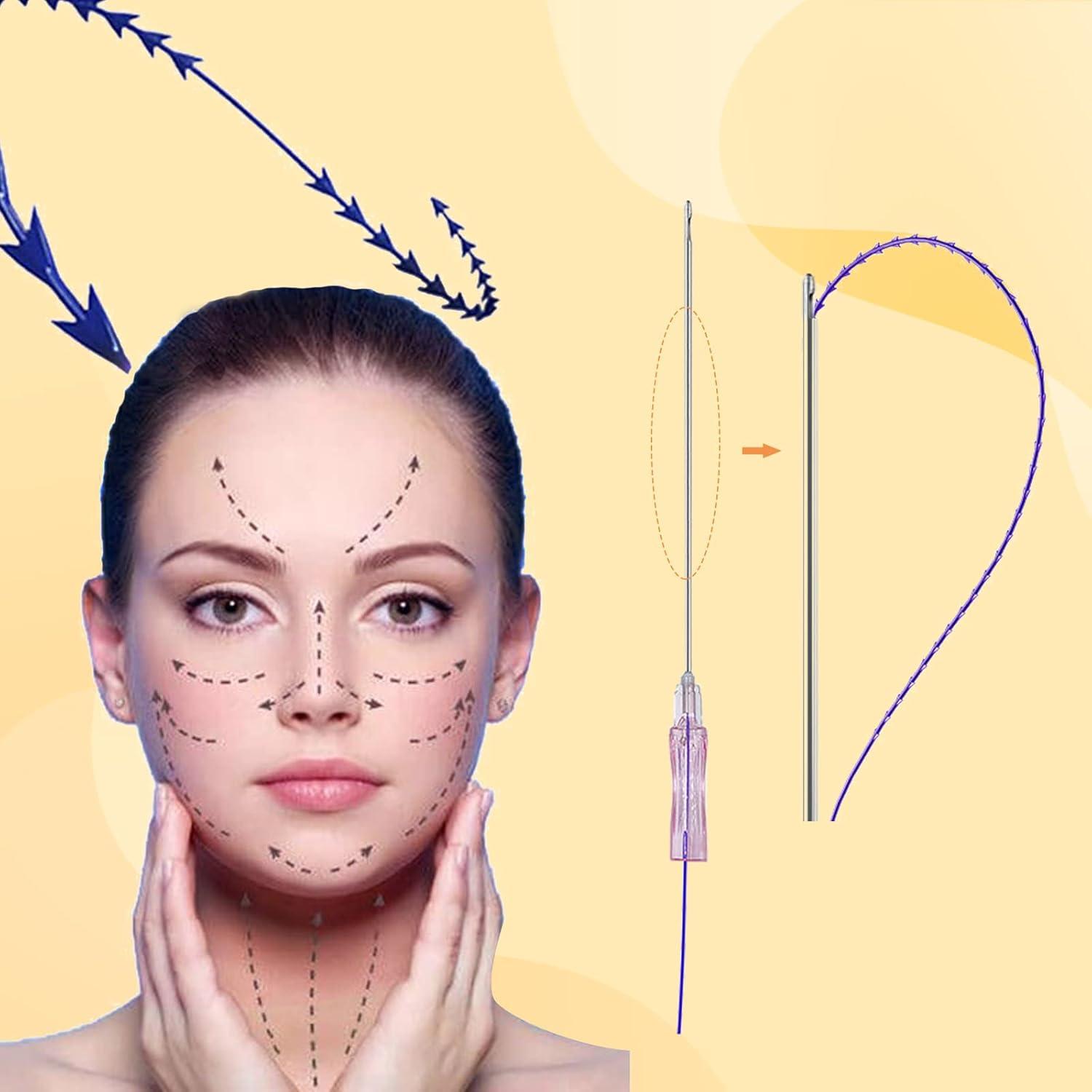 Minovd PDO Fishbone Threads - 18g 100mm W-Type Barbecue Threads 20 ...