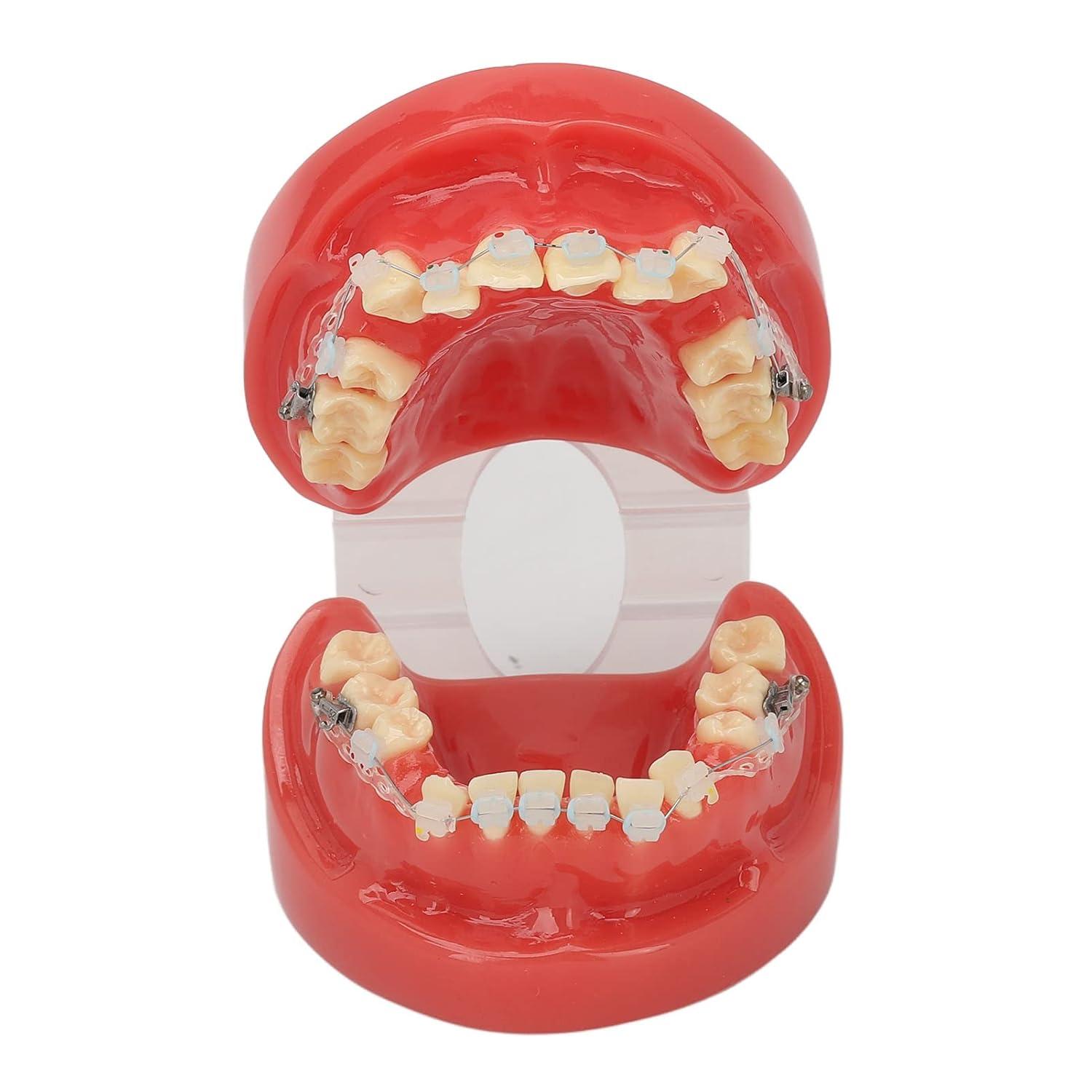 Orthodontic Bracket Model - 24 Teeth Dental Demonstration Model for ...