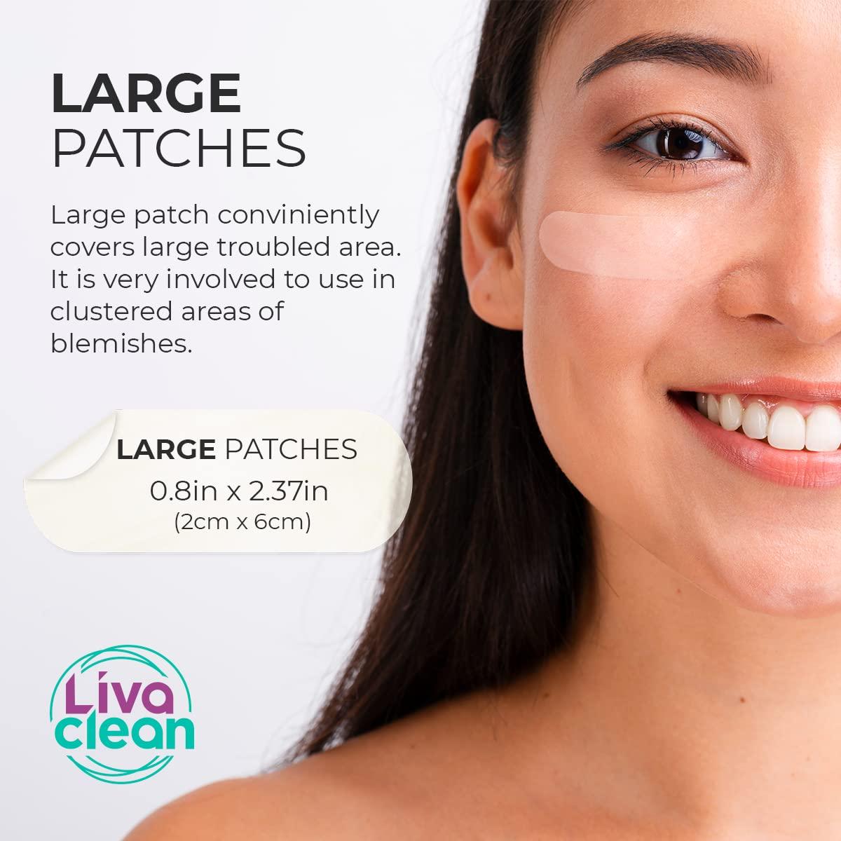 20 CT LivaClean Hydrocolloid Large Acne Patches - XL Zit Stickers for ...