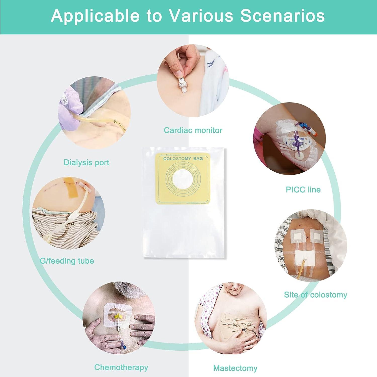 Waterproof Ostomy Protector G Tube Shower Cover Transfer Set 60pcs ...