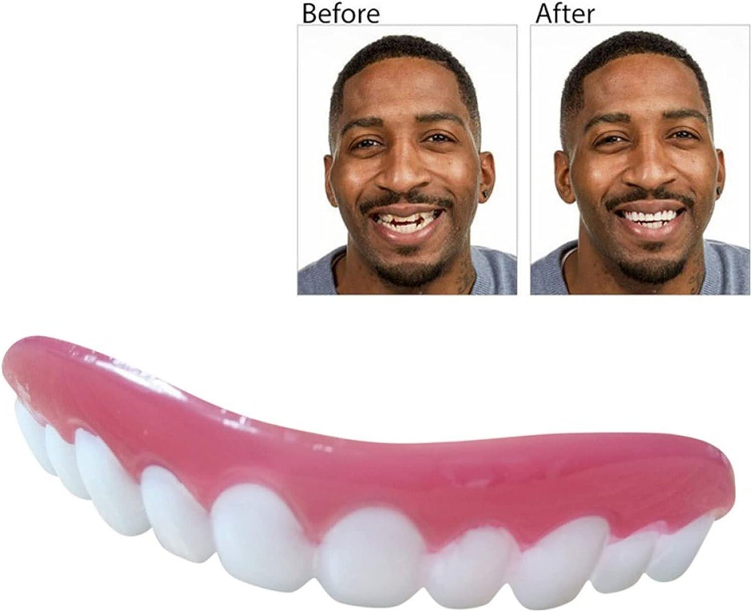 4PCS Natural Shade Denture Teeth Veneer Set for Upper and Lower Jaw ...