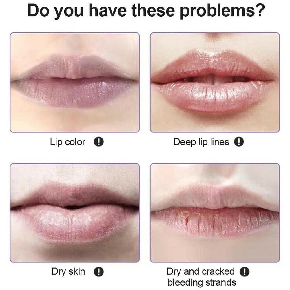 Hydrating Honey Lip Mask for Color-Fading & Smooth Lips | International ...