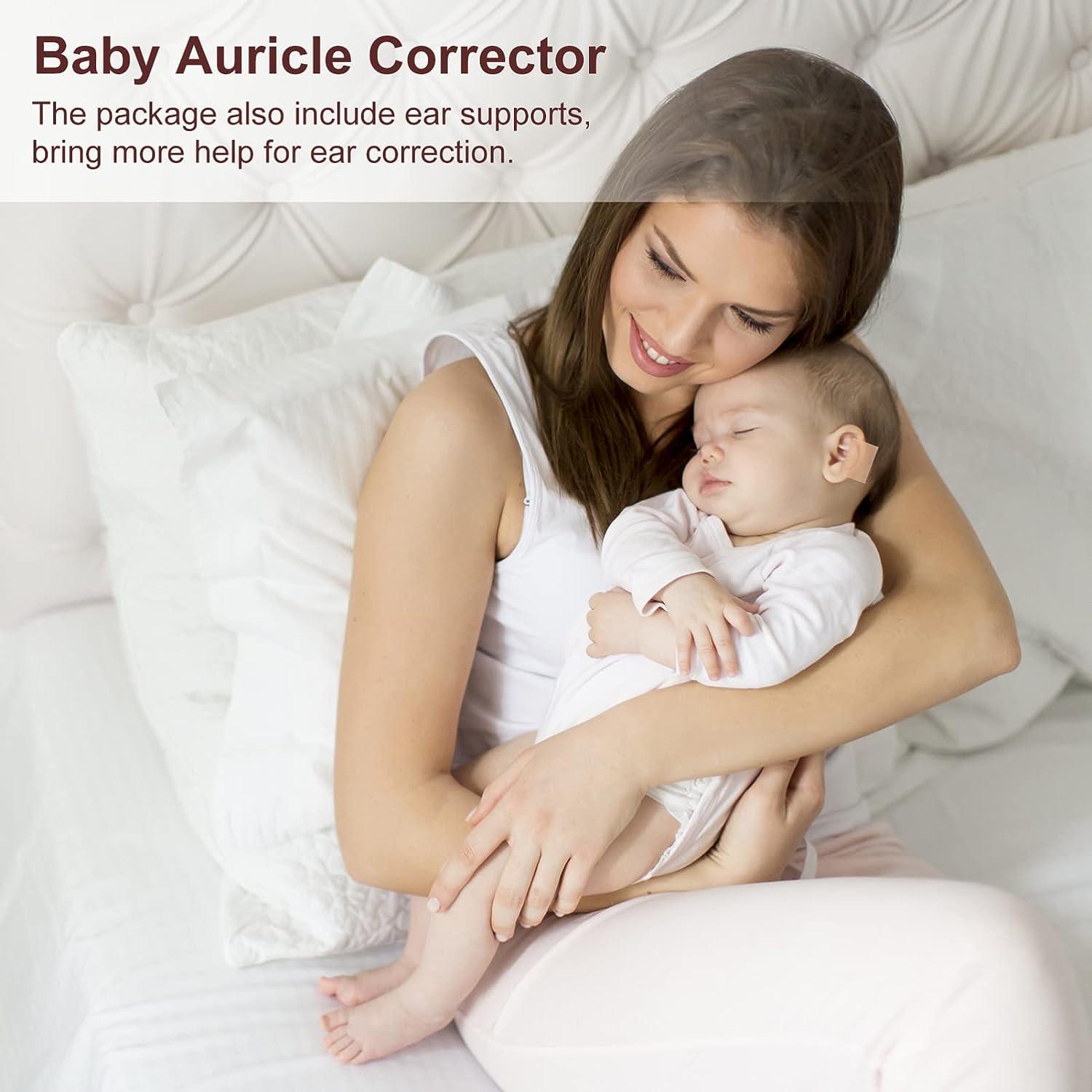 ToddMomy Baby Ear Corrector - Auricle Correction Patch for Protruding ...