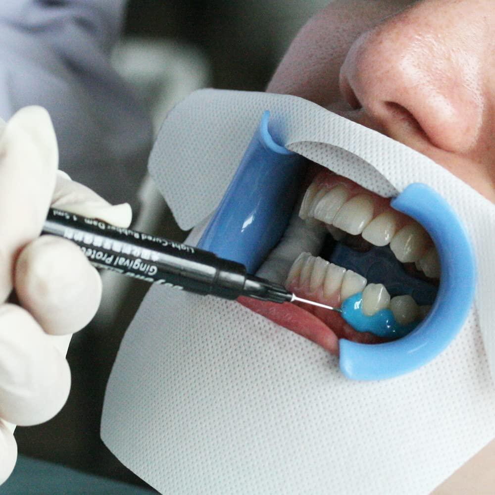 BEYOND BlueSeal Gingival Protection 5-Pack - Dental Care Gum Protector ...