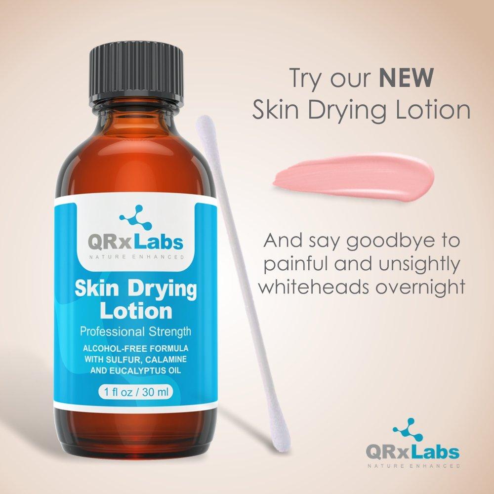 Drying Lotion - Alcohol-Free Acne Spot Treatment with Sulfur ...