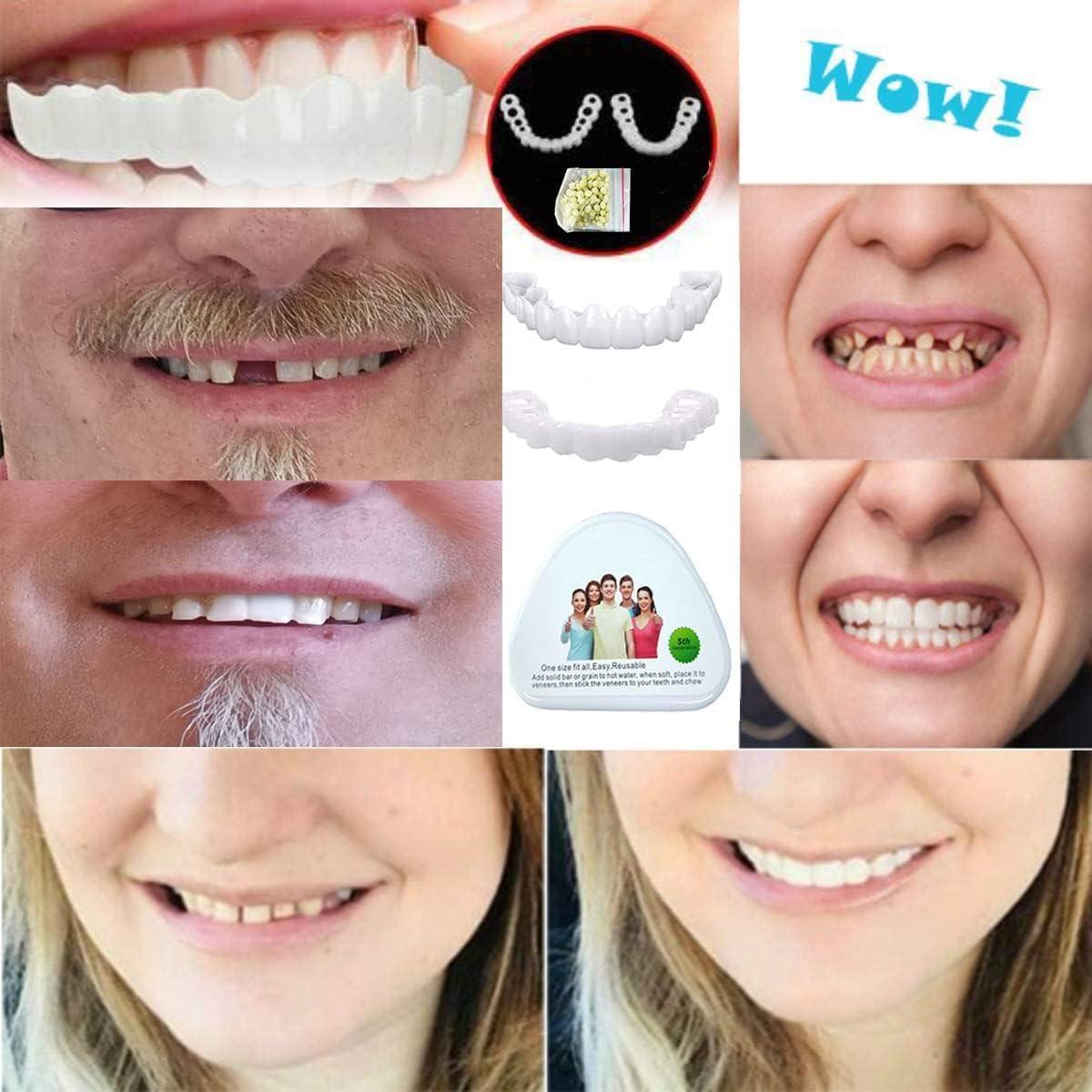 Shop Dazzle Instant Tooth Veneers | 2 Pairs of Cosmetic Snap-On Teeth ...