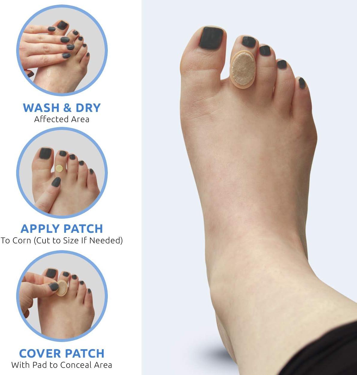 Comfort Zone Corn Removers Medicated Patches Effective Corn Removal ...