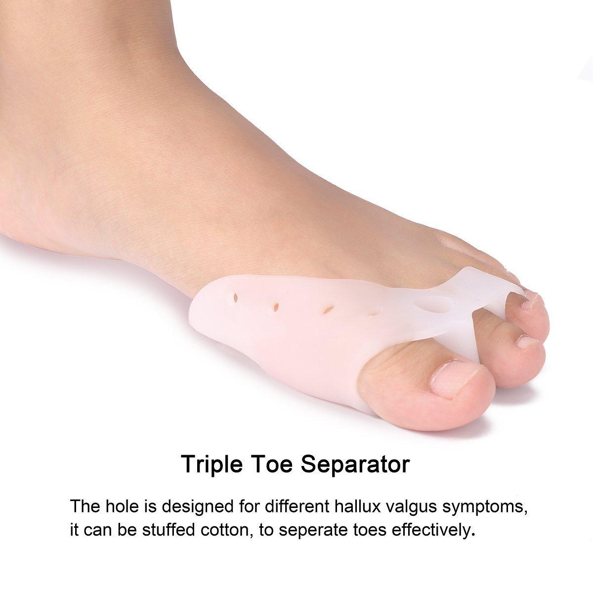 Hallux Valgus Toe Spreader - Soft Comfortable Treatment for Hammer Toes ...