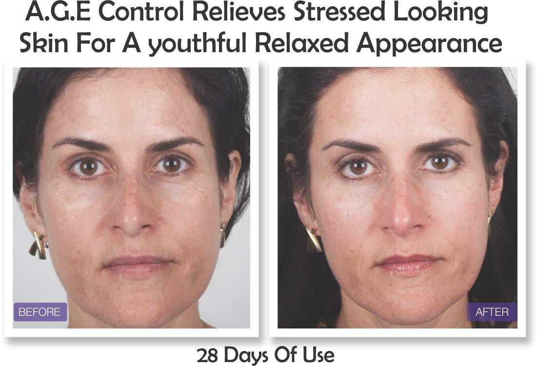 AGE Control Dual Treatment Anti Glycation Serum - Look 8-10 Years ...