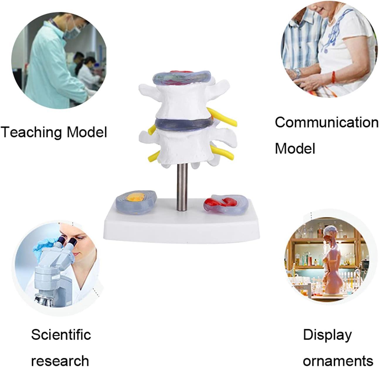 Anatomical Lumbar Intervertebral Disc Model - Spine Demonstration for ...