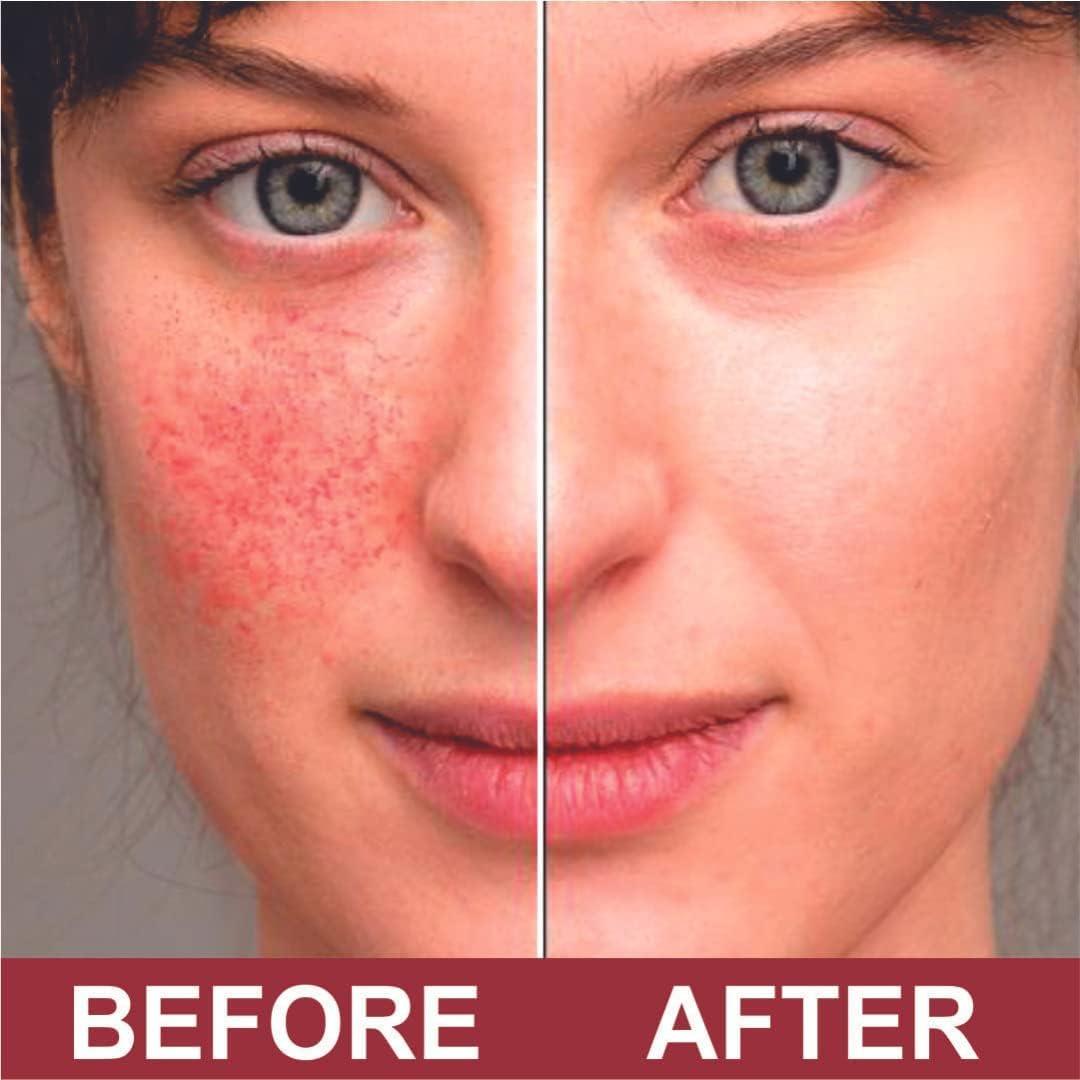 Quatriderm NF Extra Strength 1% Hydrocortisone with Aloe Vera - 2 oz ...