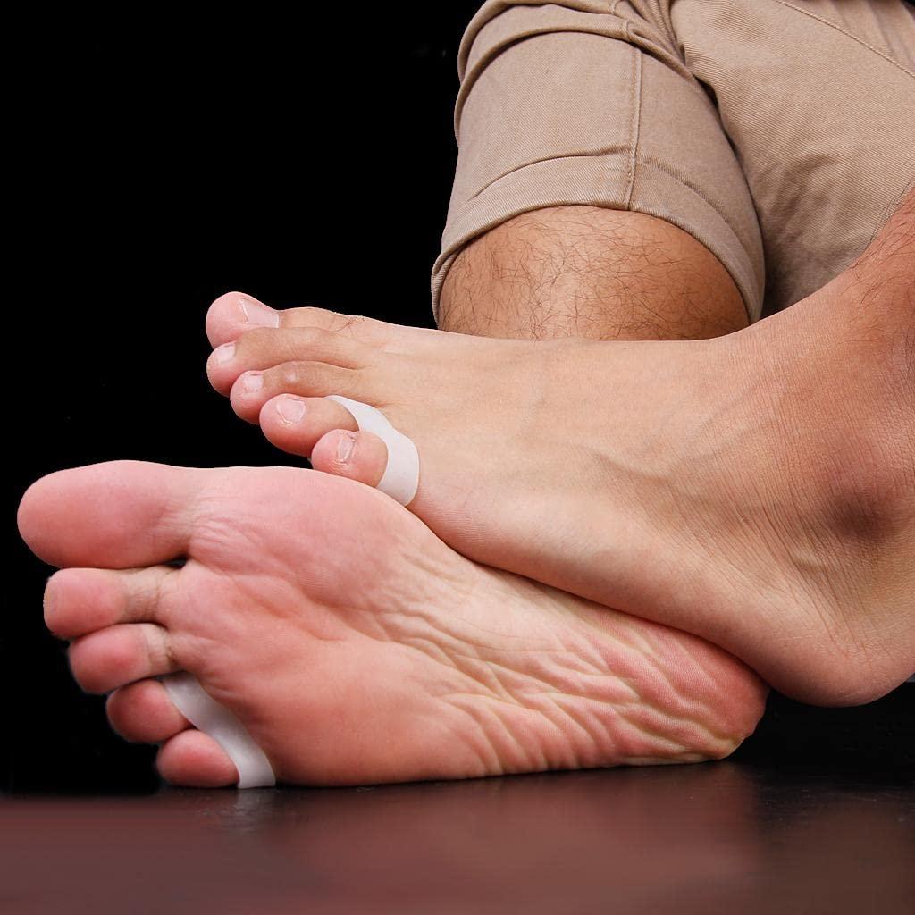 ZRWC15 Toe Valgus Corrector Kit - Pain Relief & Toe Alignment Solution ...