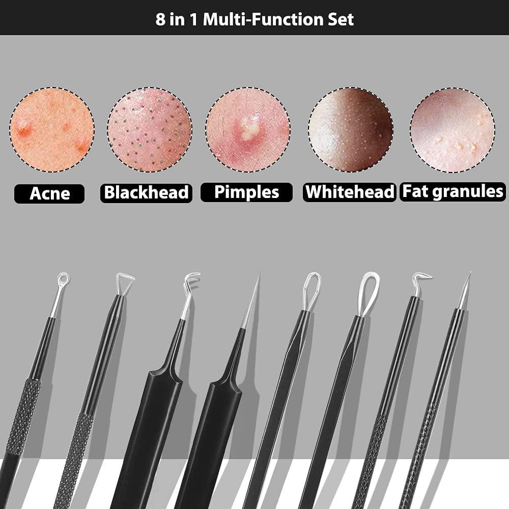 Glamne Blackhead Remover Pimple Popper Kit - Acne Comedone Extractor ...