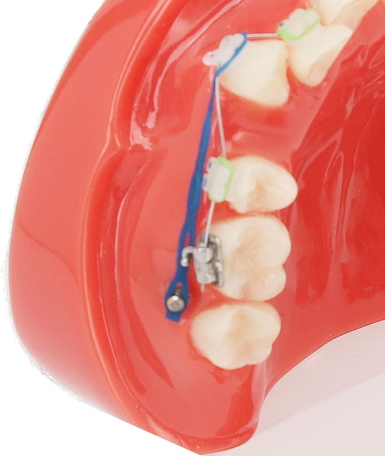 Buy Verdant Touch Metal Wires Tooth Model - 24 Teeth Semi-Metal ...