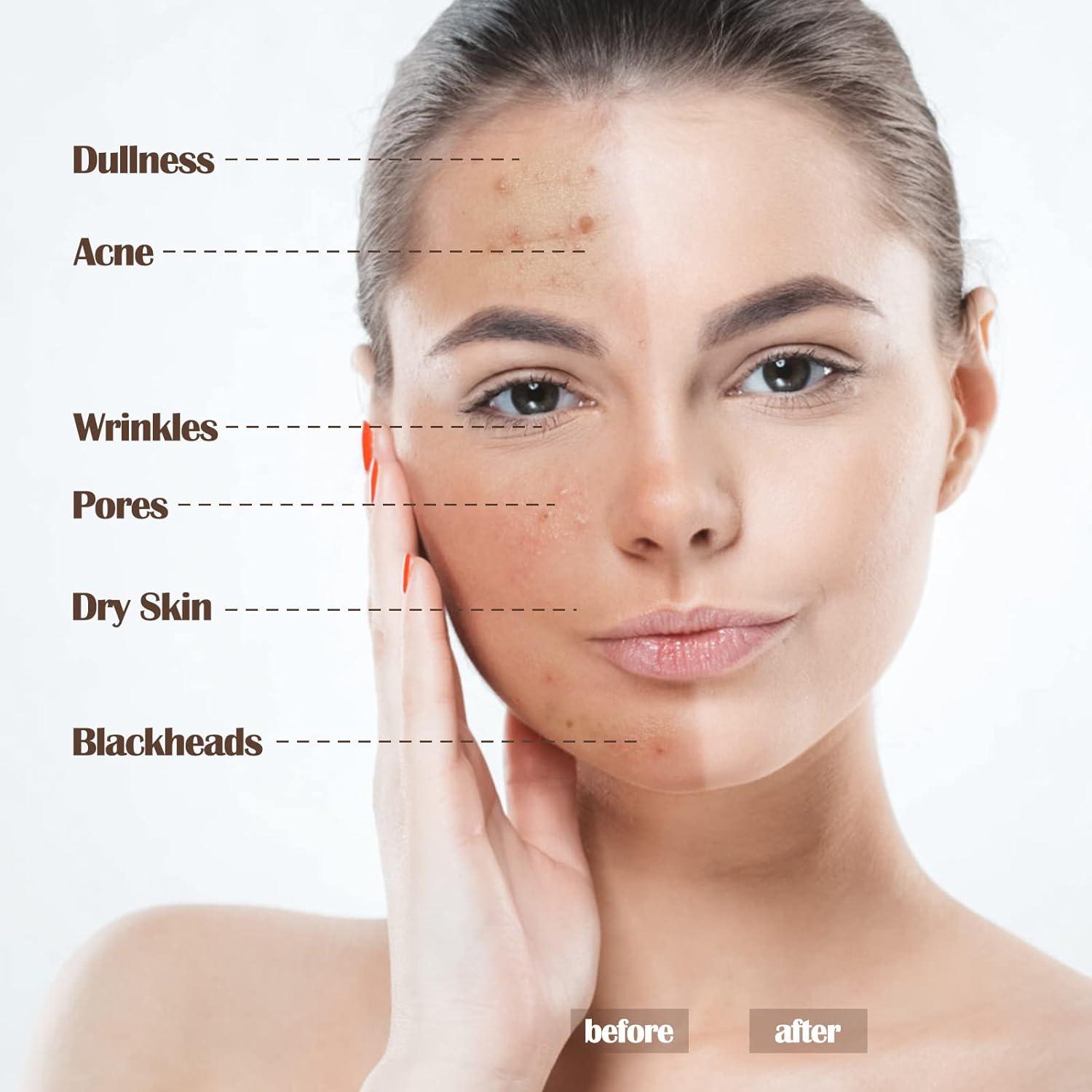 Aquapurity Phoera Full Coverage Foundation 30ml - 103 Warm Peach | Soft ...