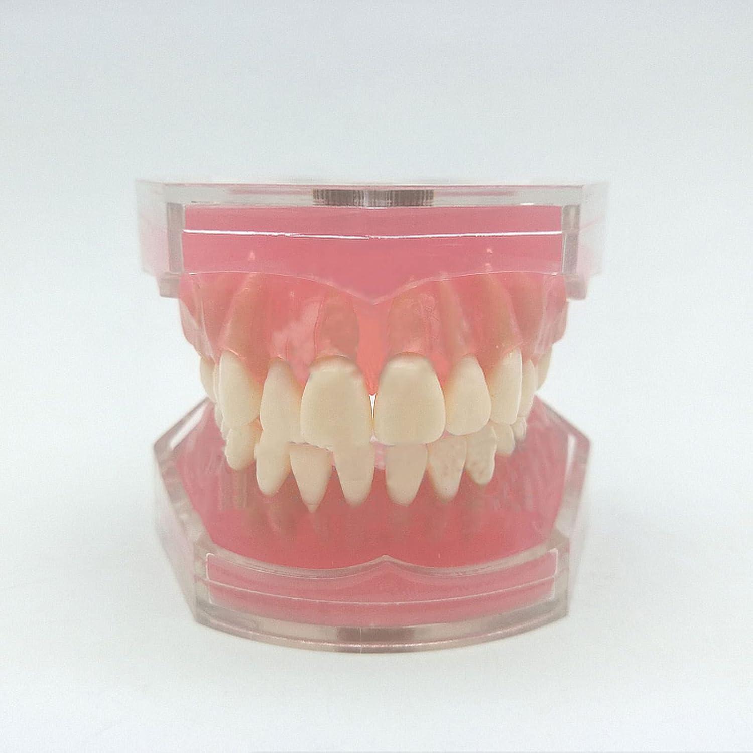 Standard Dental Teeth Model - Removable Full Mouth Resin Crown Model ...