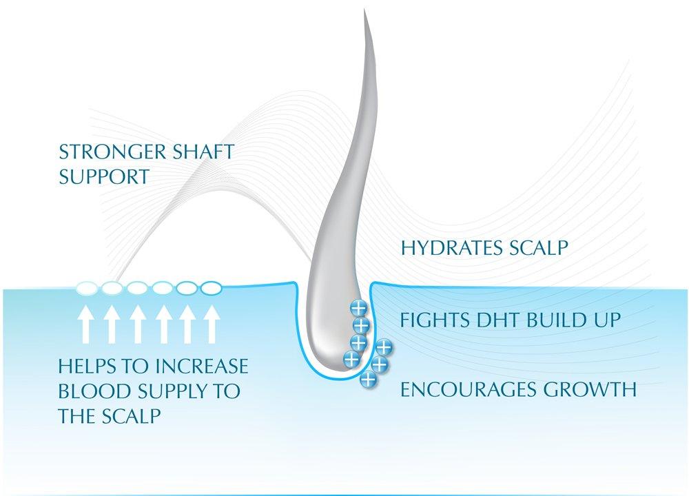 Biotopic Regrowth Serum for Receding Hairline & Bald Spots - 1oz | Buy ...