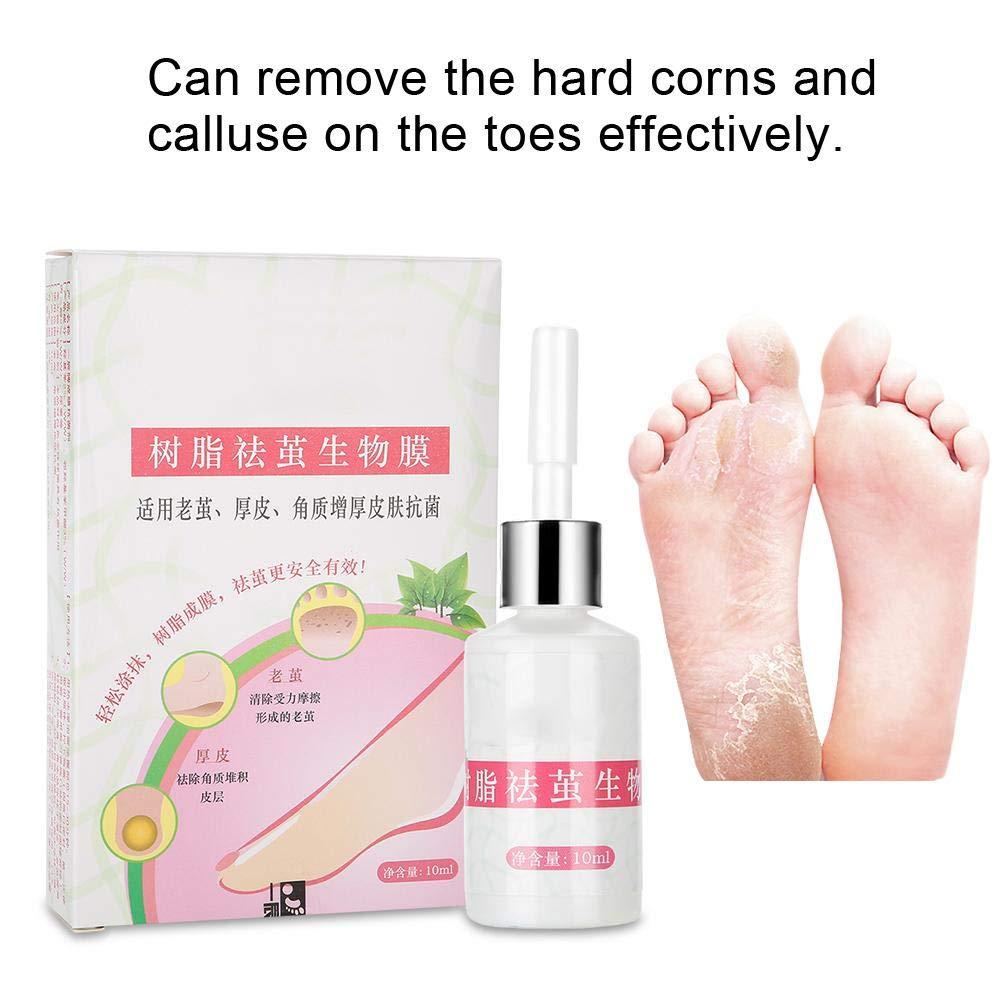 Foot Corn Plaster - Callus & Corn Removal Cream for Pain Relief - 10ml ...