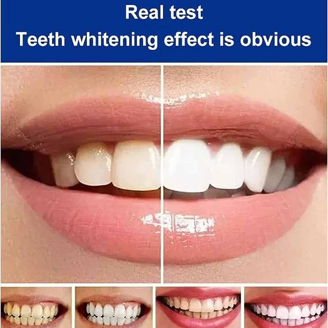 Shop Sopami SP-7 Probiotic Toothpaste & Toothbrush - Whitening Stain ...