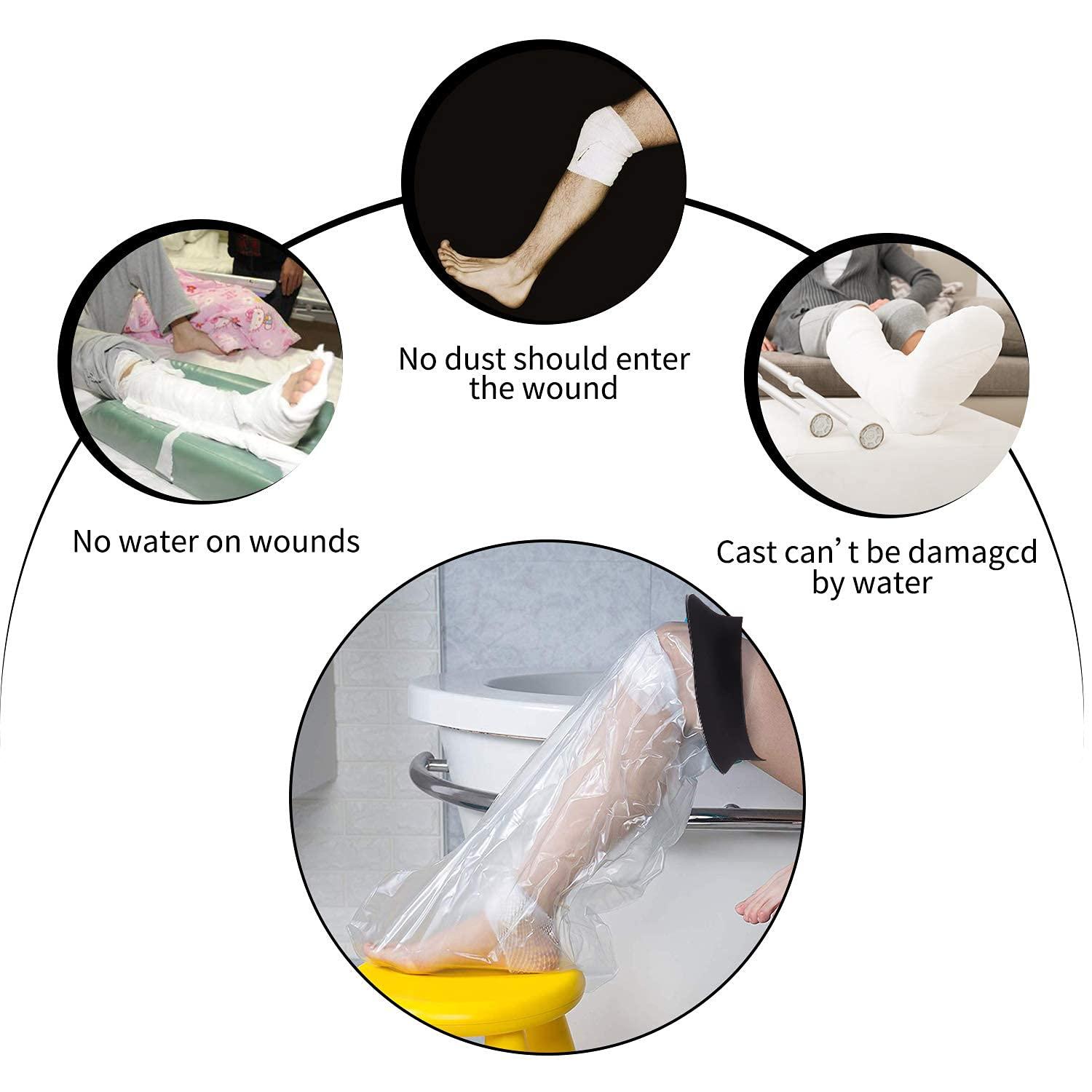 Waterproof Leg Cast Cover for Adults - Shower Protector for Broken Legs ...