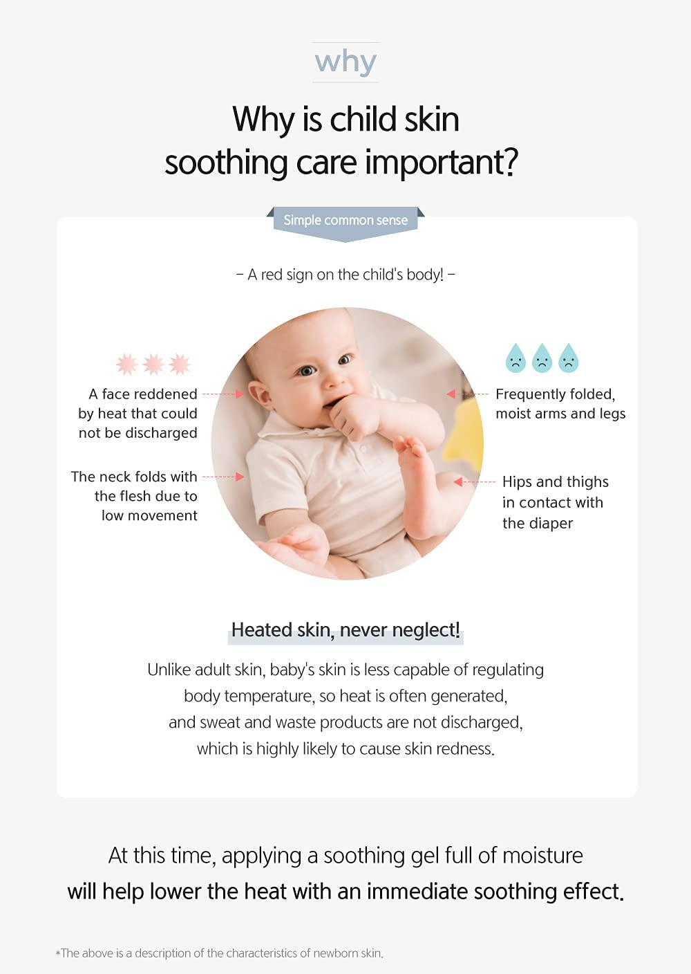 Mongdies Baby Soothing Gel - Cooling & Soothing Sensitive Skin Solution ...