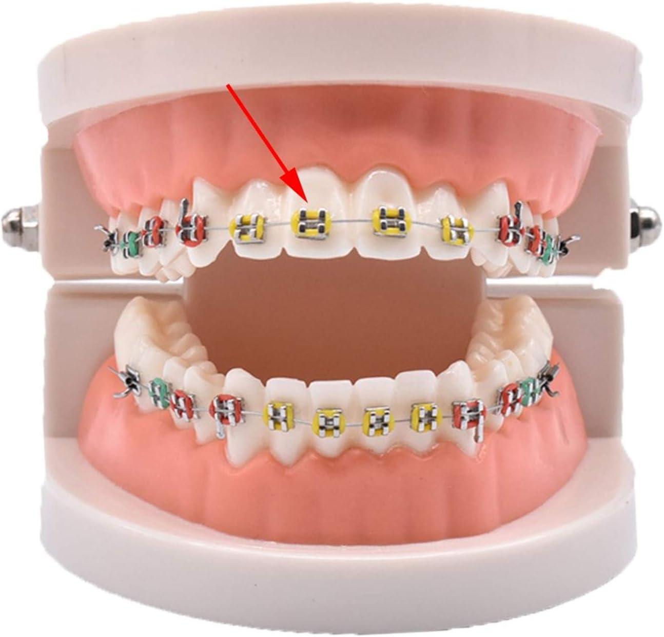 Orthodontic Ligature Rubber Bands - Multi-Color O-rings for Braces ...