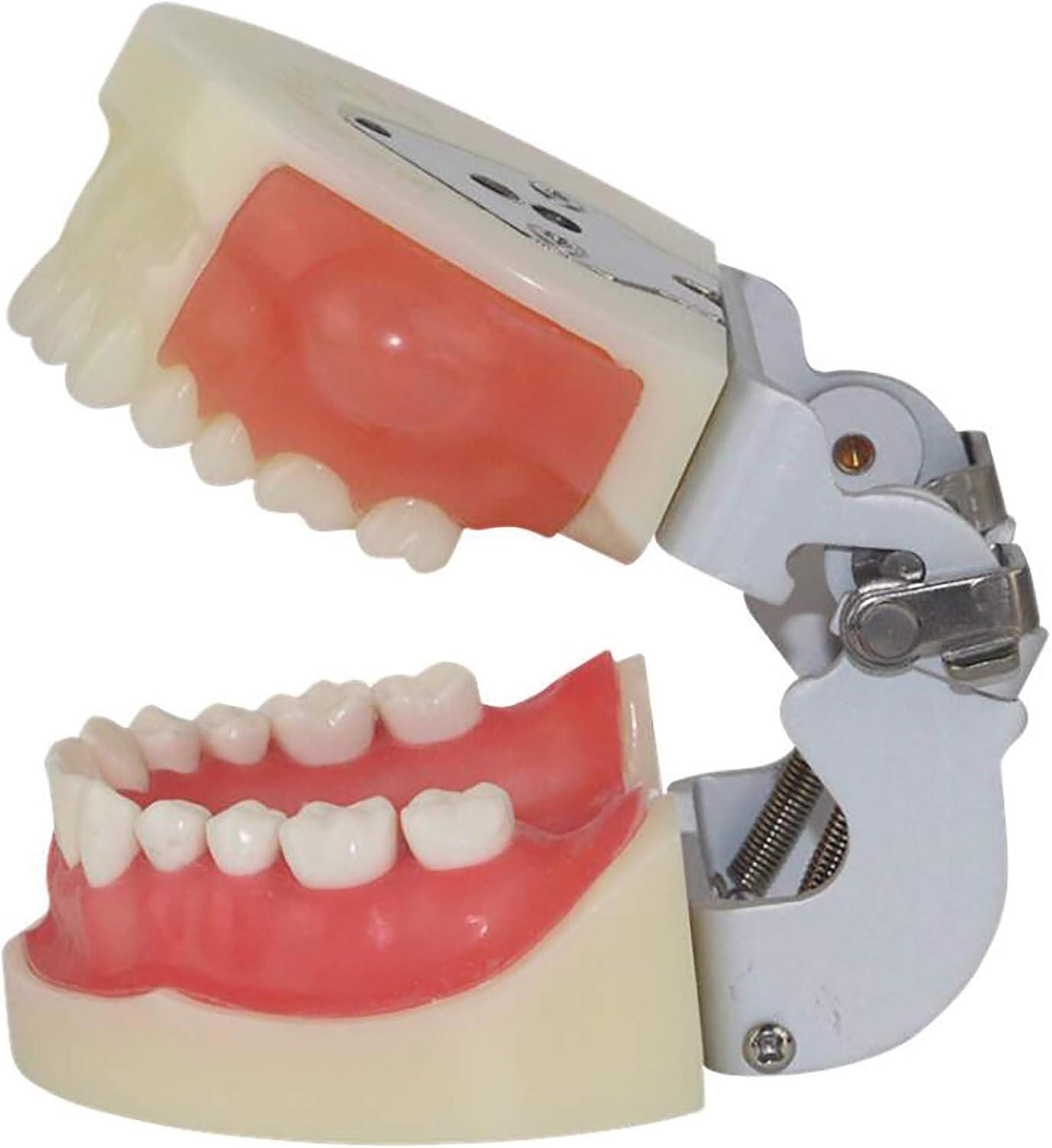 Life-Size Human Teeth & Abscess Model - Perfect for Student Teaching ...