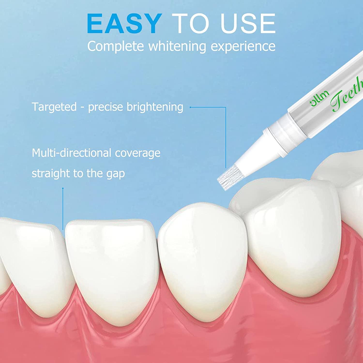 Teeth Whitening Pen Bleaching Gel - 3 Pcs Professional 20 Uses ...