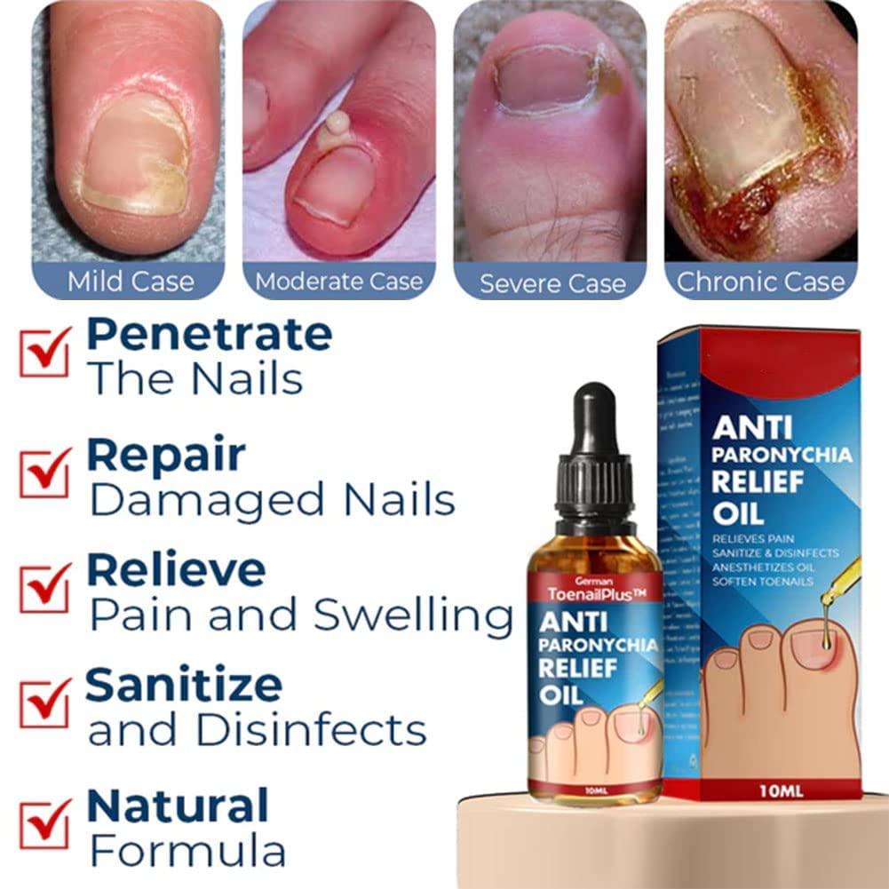 2PCS German Toenailplus Anti Paronychia Relief Oil - Nail Repair for ...
