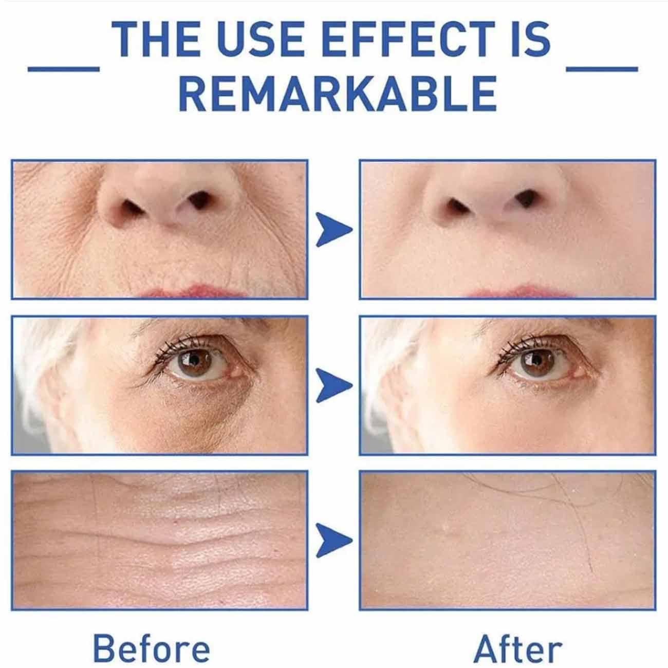 Glozie Instant Eye Lift Serum - Eye Bag Eraser & Anti-Aging Treatment ...