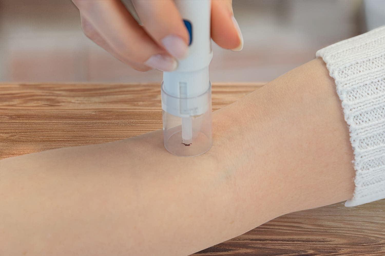 Tick Twister for Safe Tick Removal | Essential Tick Tool for Humans ...