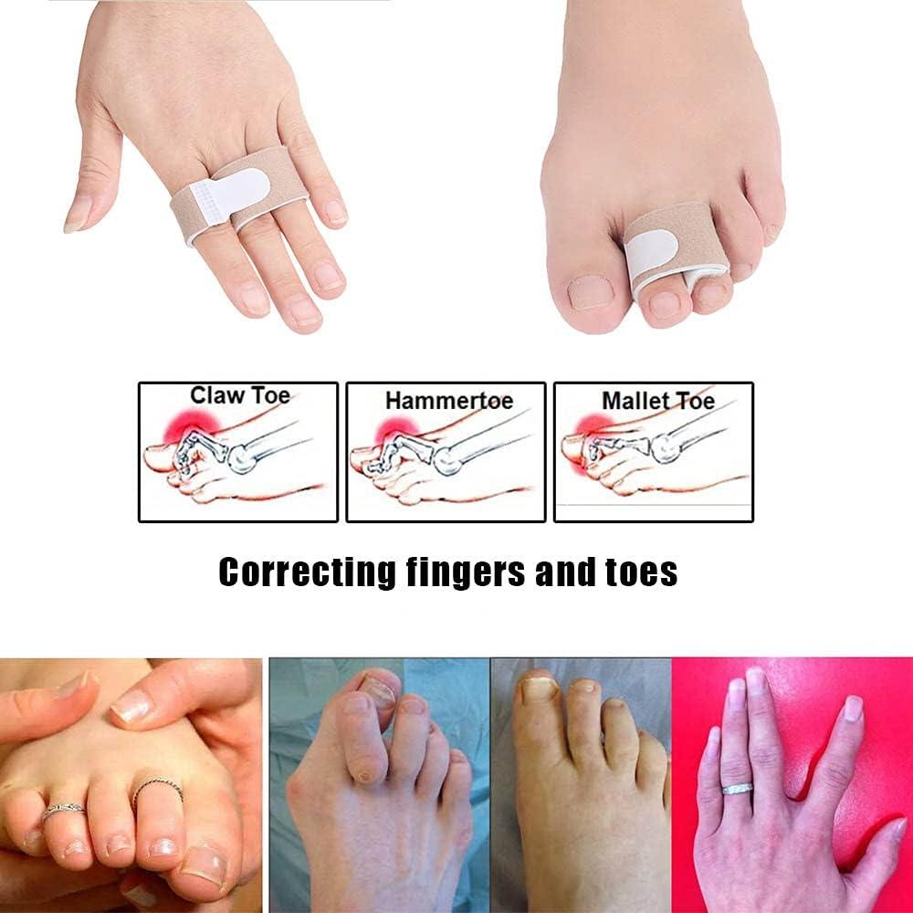 HouChanges Toe Straighteners - Reusable Splints for Bent, Hammer ...