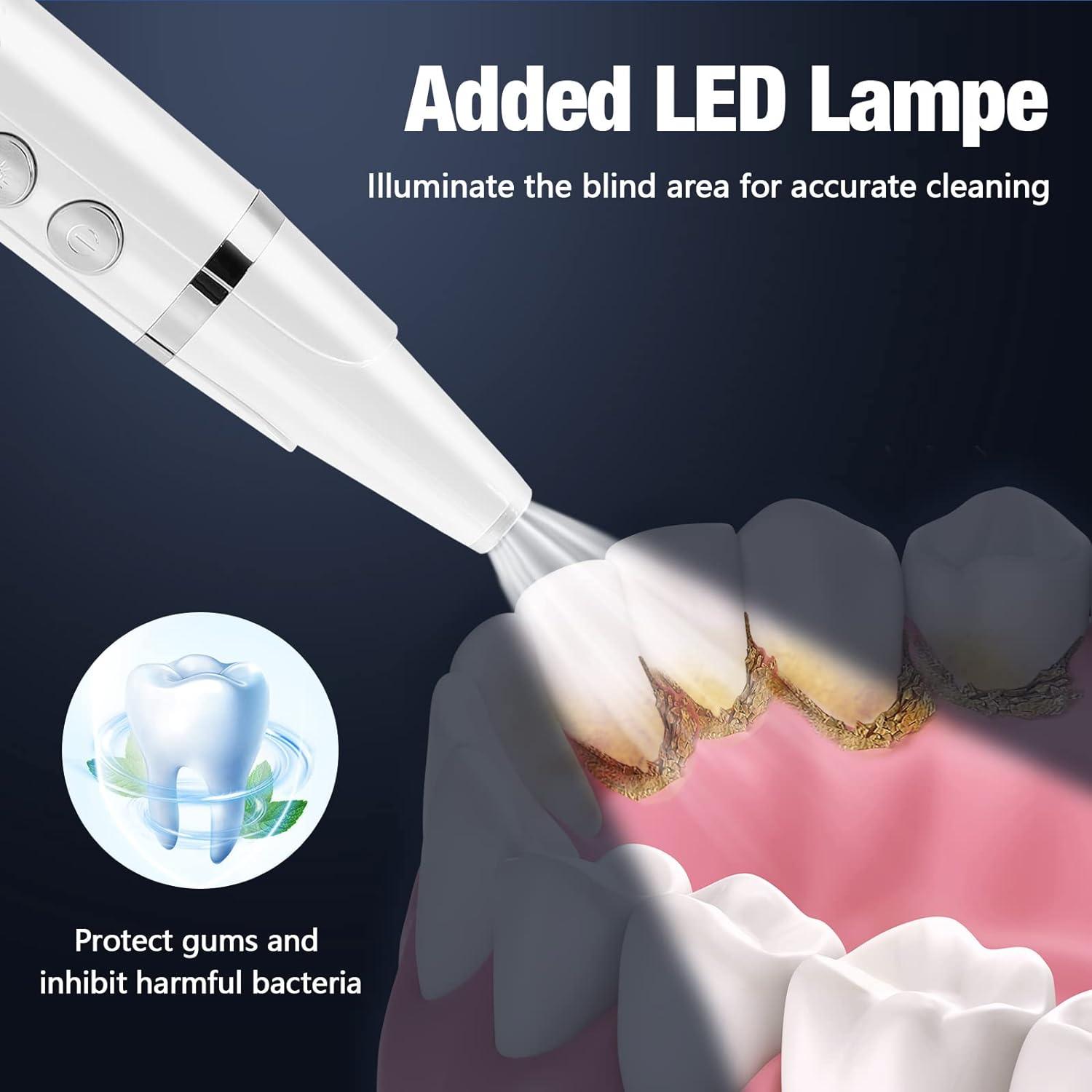 Wagner Stern Teeth Whitening Kit: 5 Modes Plaque Remover for Teeth ...