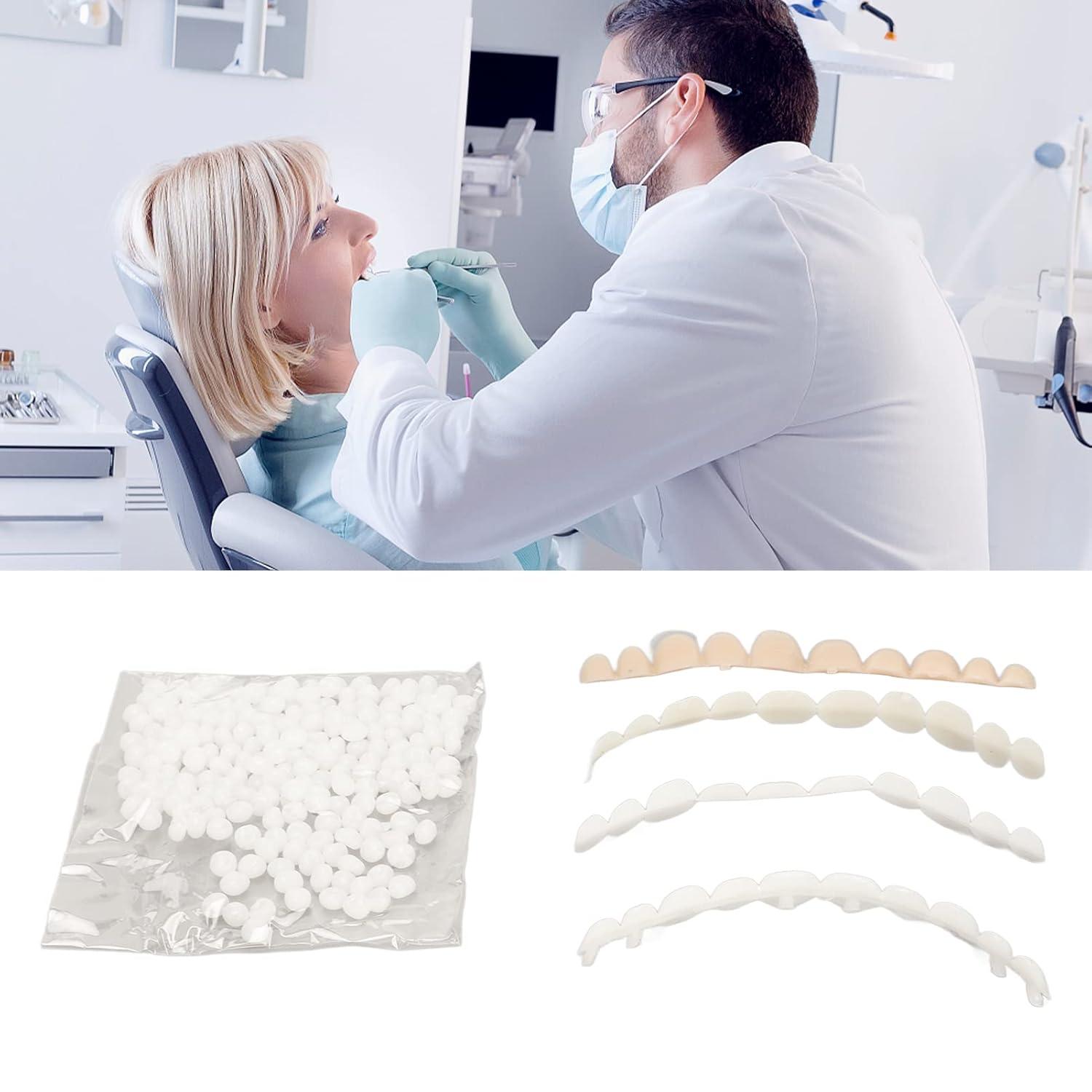 Tooth Filling Pearl Set | Temporary Tooth Repair Kit | Formable False ...