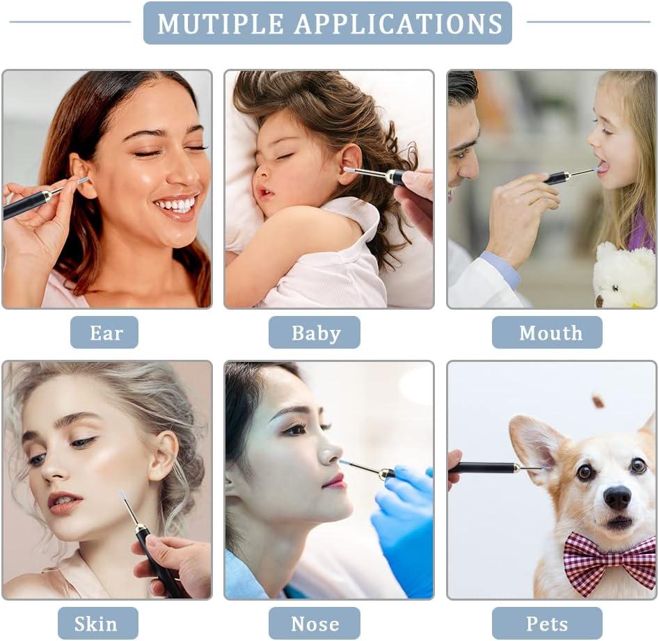Wireless 1080P FHD Ear Wax Removal Tool Camera with LED | Smart Visual ...