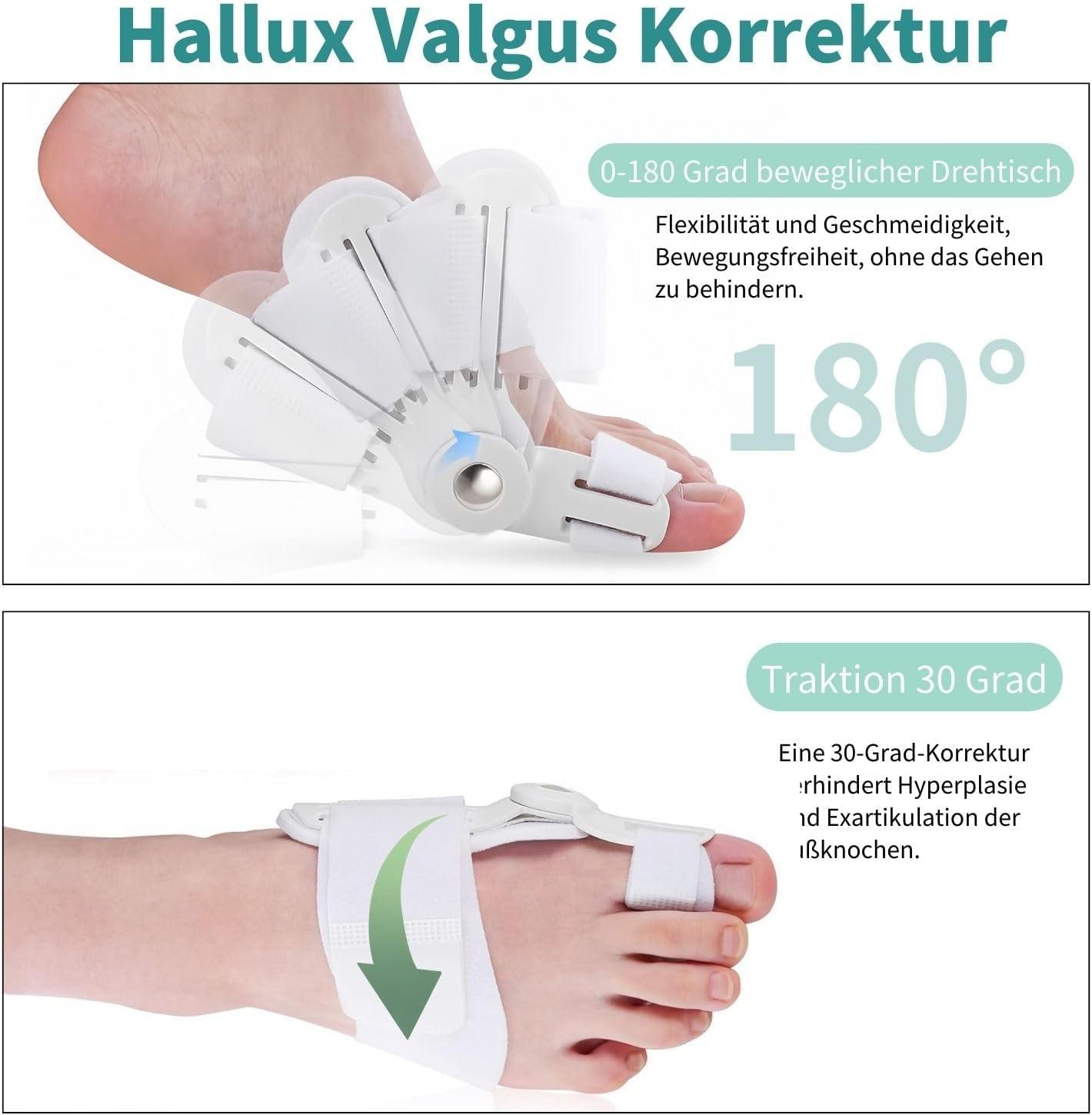 Adjustable Hallux Valgus Correction Rail for Big Toe Straightening ...