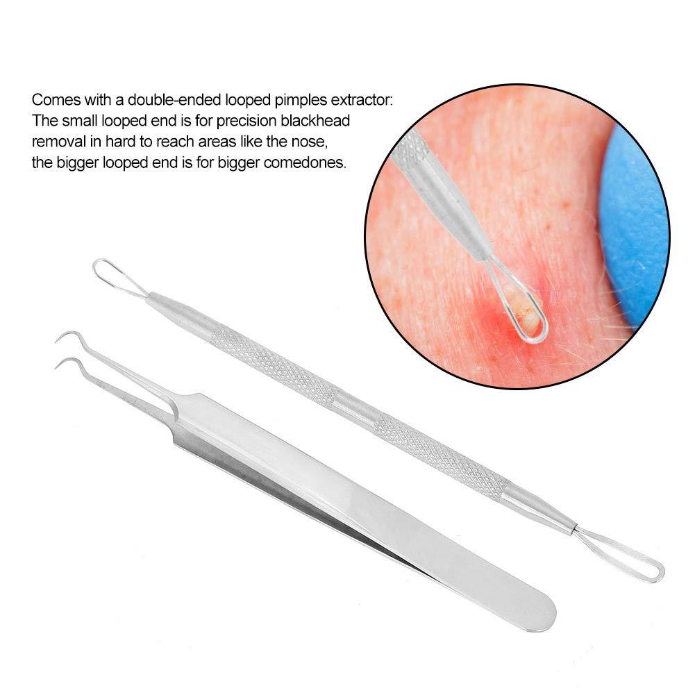 Premium Stainless Steel Blackhead & Pimple Removal Tool Set - Curved ...