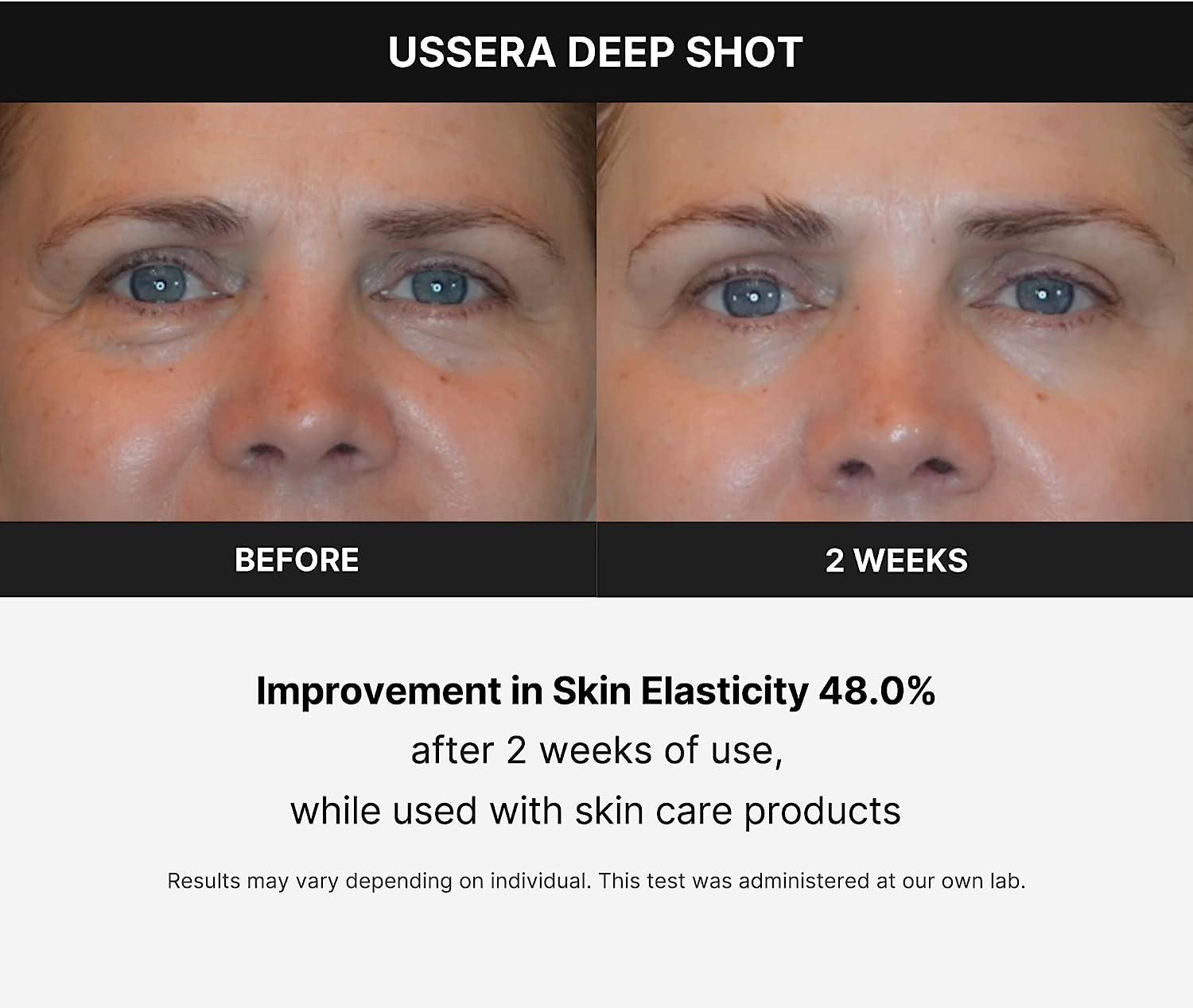 Medicube Age-R USSERA - Advanced Anti-Aging Device | Buy Now in ...